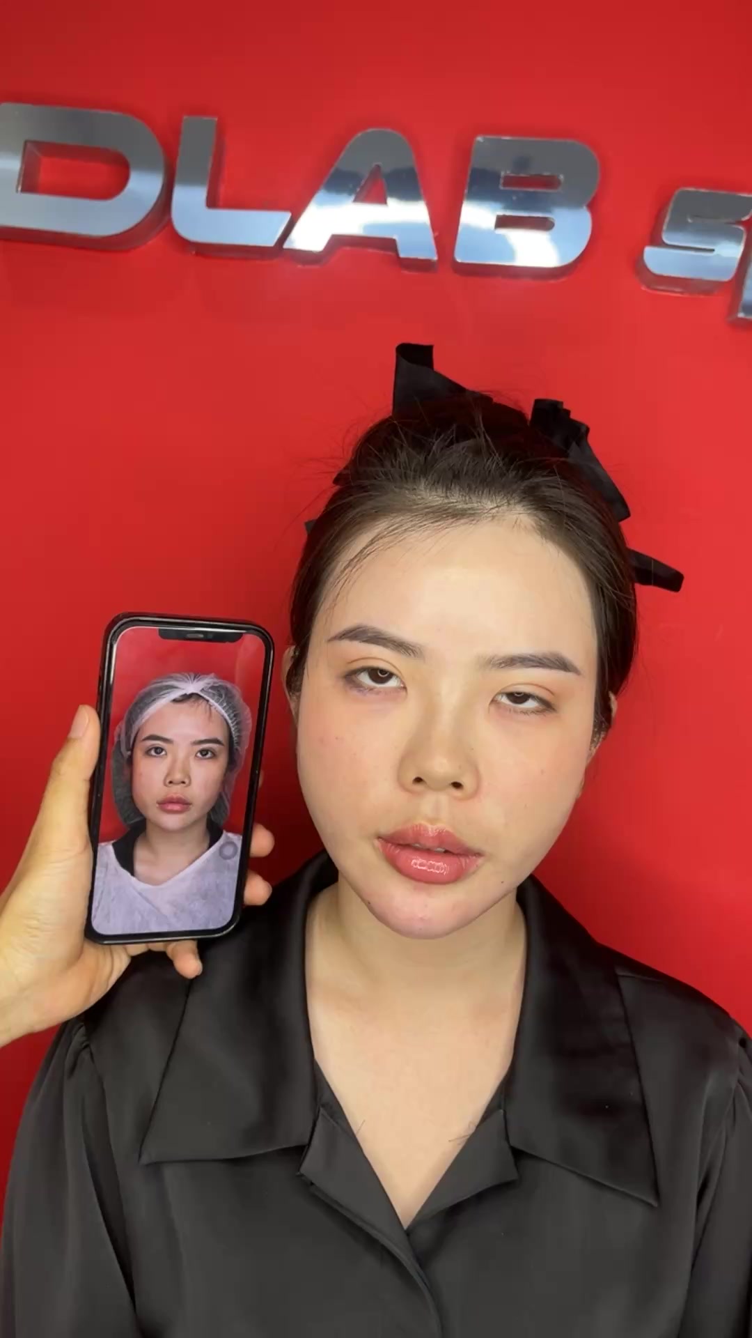 Cân chỉnh Fullface Douyin - Madlab Aesthetic & Academy