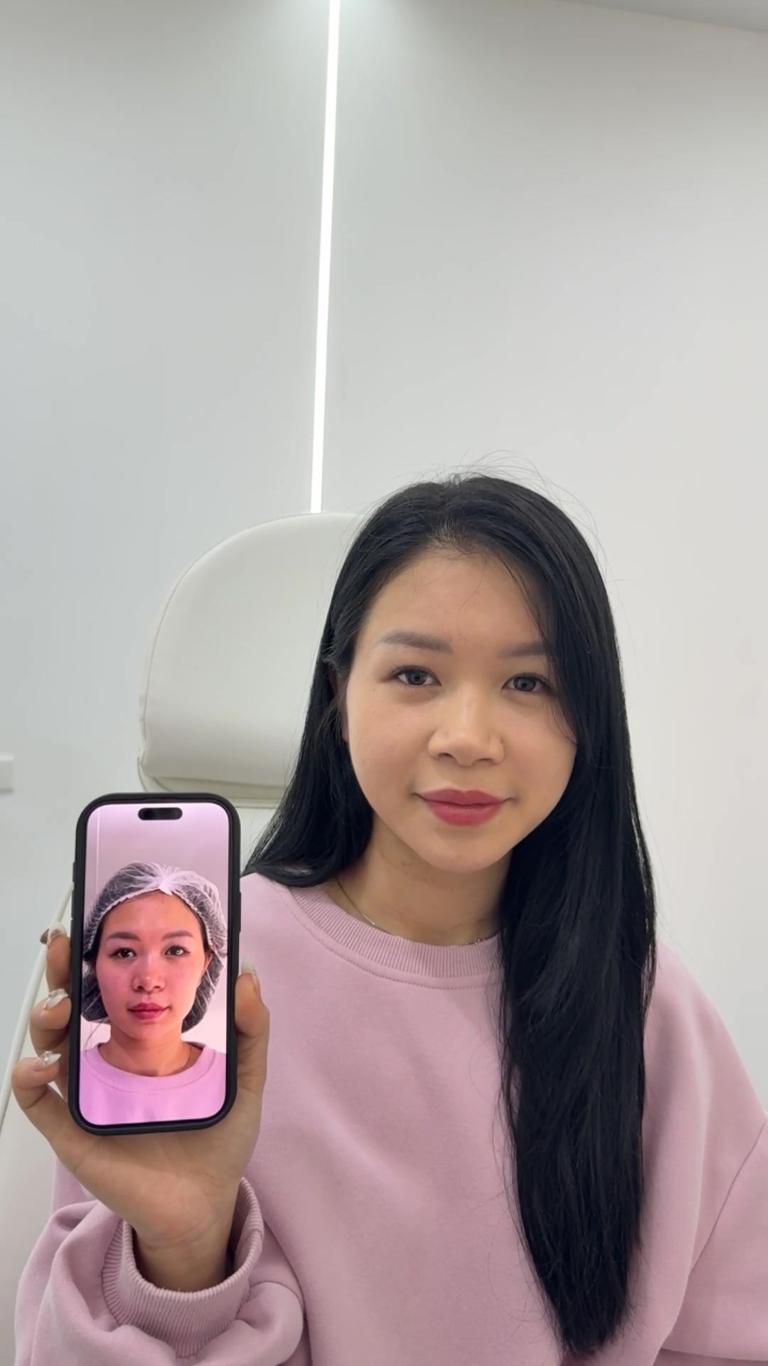 Full face douyin cho chị khách - Madlab Aesthetic & Academy